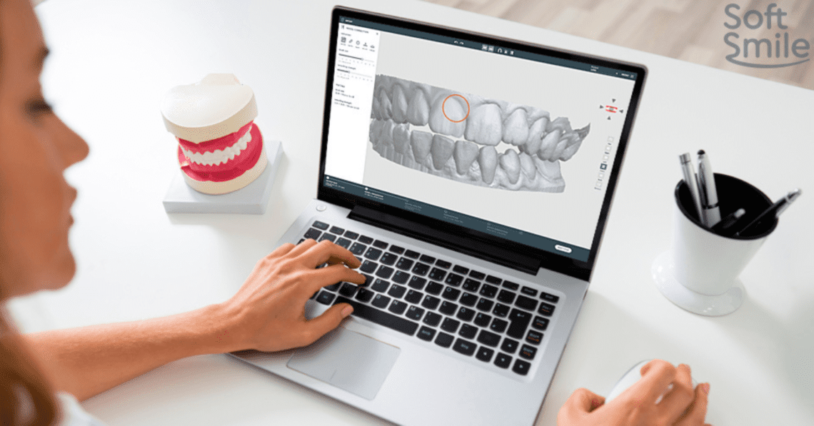 SoftSmile ၏ မျှော်မှန်းချက်- သွားနှင့်ခံတွင်းကုသရေး အစီအစဉ်တွင် AI-မောင ...